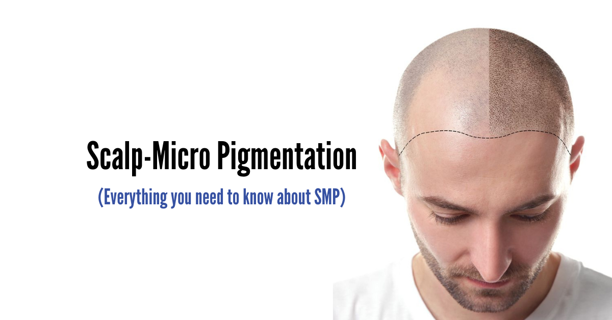 All You Need To Know About Scalp-micro Pigmentation - Flow PMU